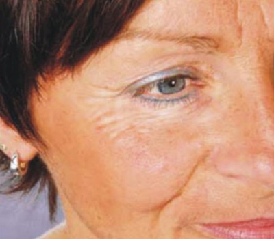 Collarium - colagenová terapie :: JK Studio